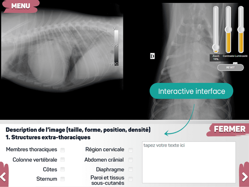 Blended clinical training on chest X-Rays - Wolf Learning Consulting